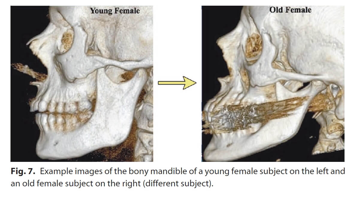 額のアンチエイジング-facial antiaging①- Dr. hideyoshi blog